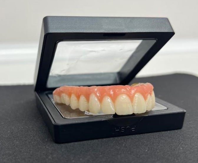 Prostodoncia - Dental Almazara